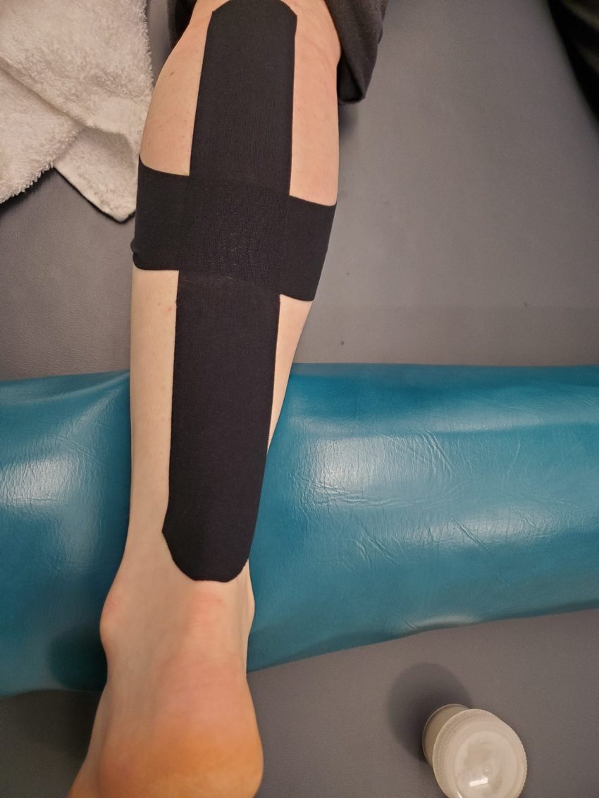 Why Achilles injuries take so long to heal - Climb From Injury